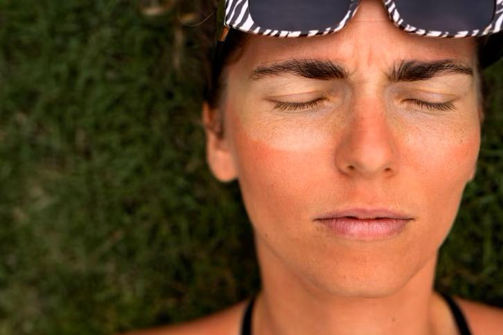 How to Reverse Sun Damage: Expert Tips for Brighter, Healthier Skin ...
