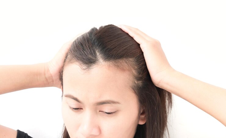 How to Prevent Hair Fall? Save your hairline with some practical tricks ...